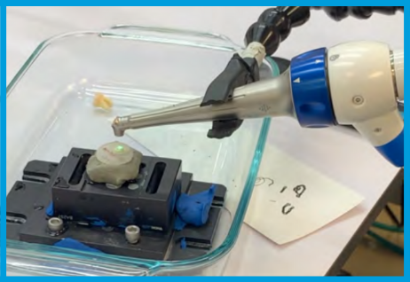 Use of 9.3µm CO2 Laser for Removal of Zirconia Restorations